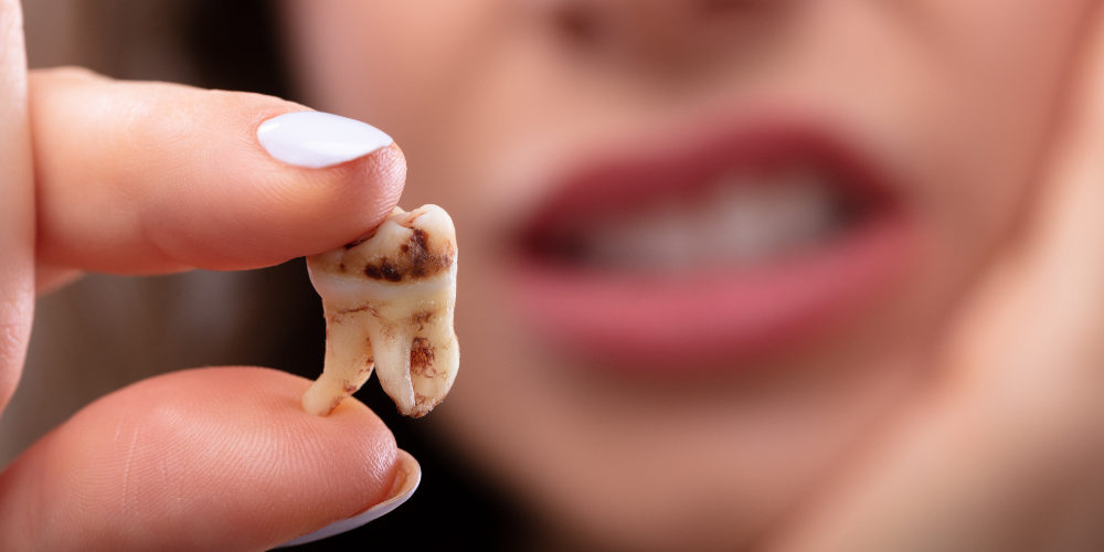 Early Signs of Oral Cancer - Rockland Dental Specialists